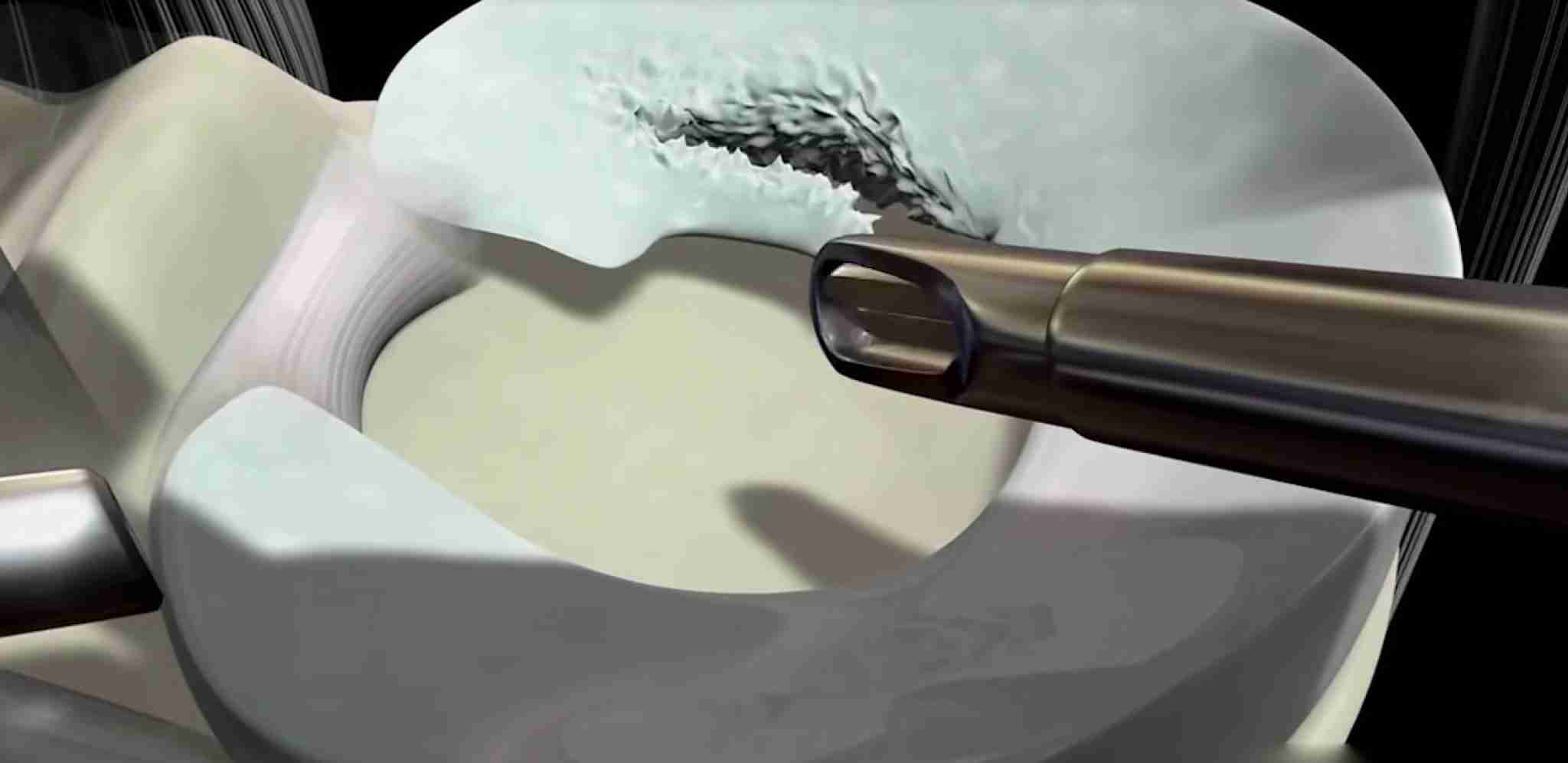 Shaver Systems | Arthroscopy | Grandtek Medical